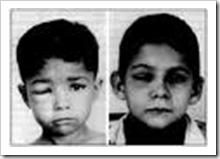 Mais Saúde: Doenças de Chagas (Tripanossoma cruzi)